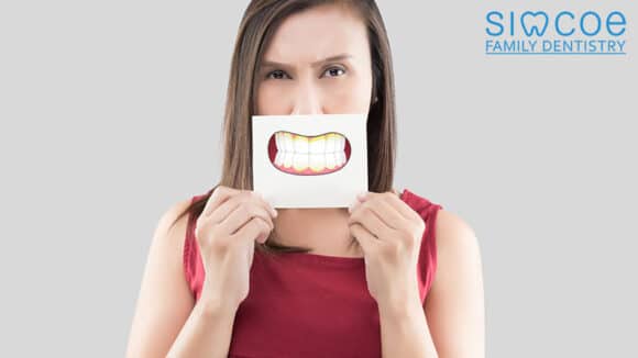 Plaque vs Tartar (Calculus) – What is the Difference!?